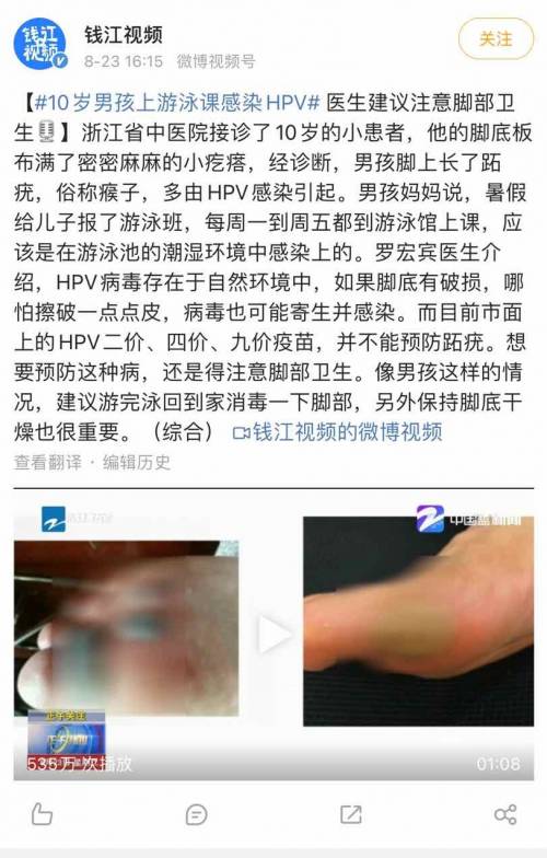 10岁男孩上游泳课感染hpv Hpv的感染途径有哪些?平安健康